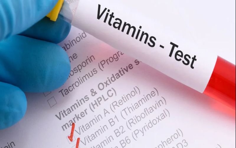 How Often Should You Get a Vitamin Test